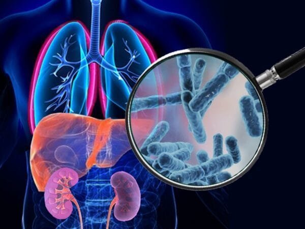 Tuberculosis y consultorios dentales | Odontología Actual
